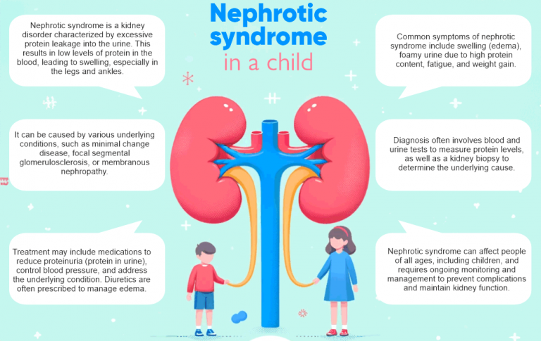 Why Prednisolone is used in nephrotic syndrome – Your well-being and ...